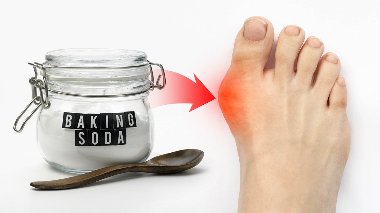 Baking Soda For Gout: A Natural Remedy Worth Exploring